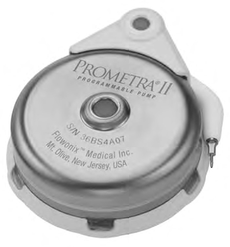 Breakthroughs in Implantable Programmable Pump (IPP) Technology