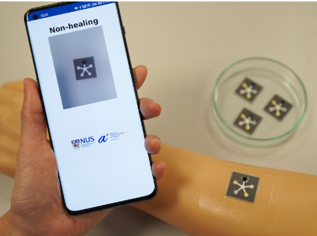 Smart Wound Dressings: The Future of Healing